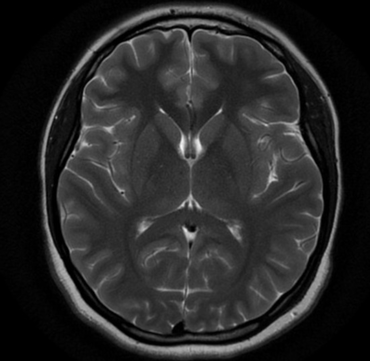 MRI Brain Course 11th February 2023